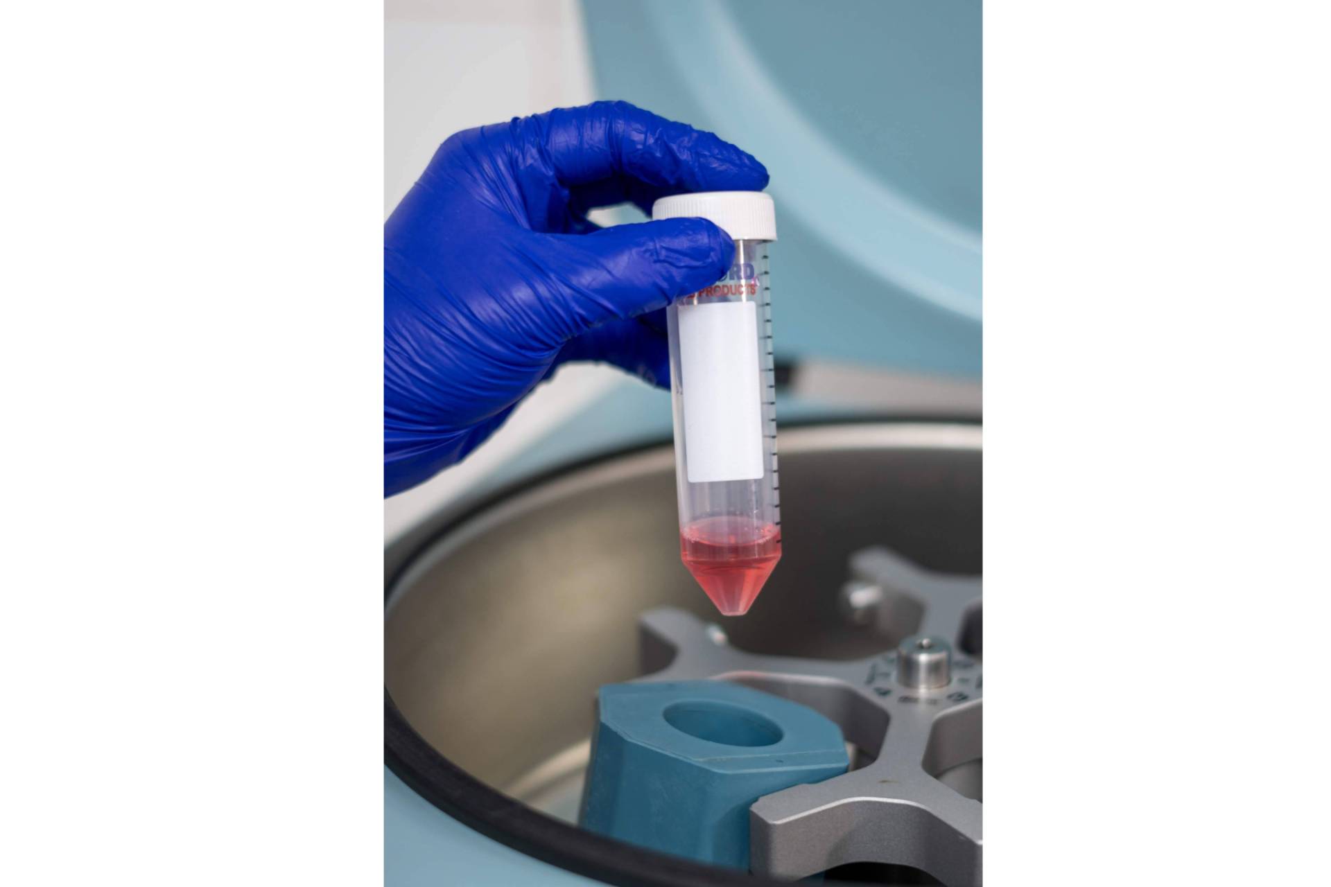 Cancer avanzado; El valioso aporte actual de la inmunoterapia DEX en el ...